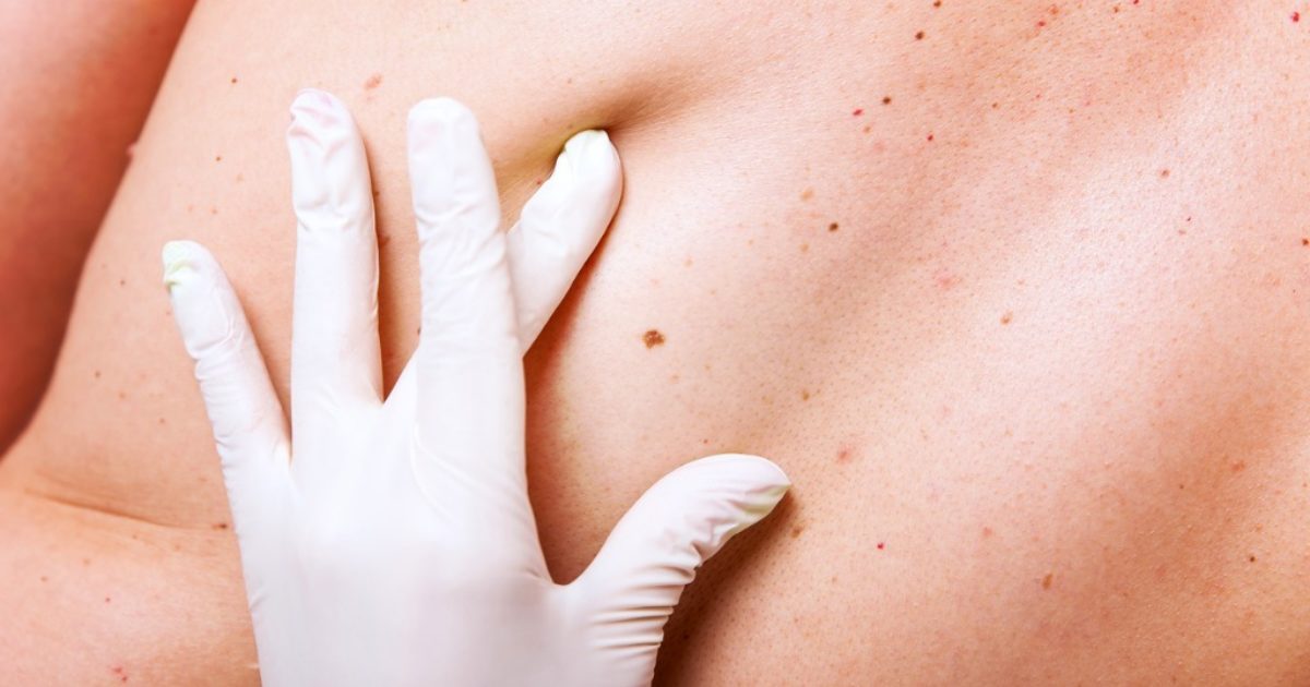 Dermatologie | AZ Alma